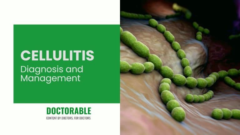 Cellulitis Diagnosis and Management - Doctorable