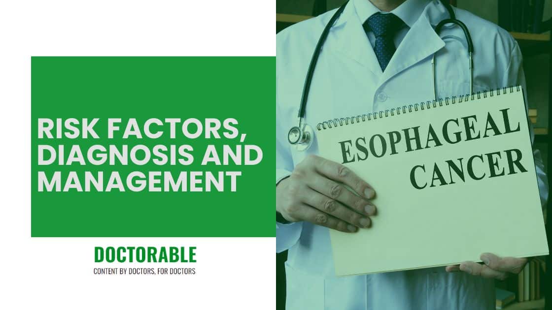 Esophageal Cancer Overview Of Risk Factors Diagnosis And Management Doctorable