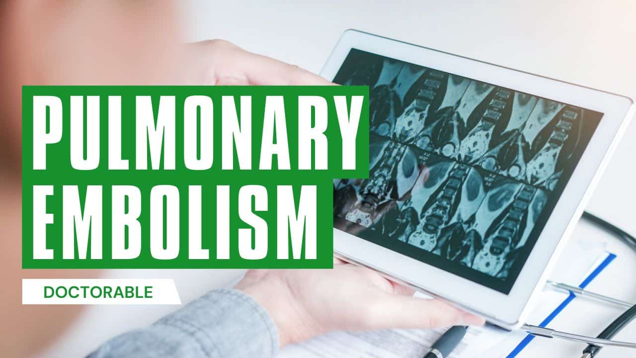 Pulmonary Embolism: Causes, Diagnosis and Management